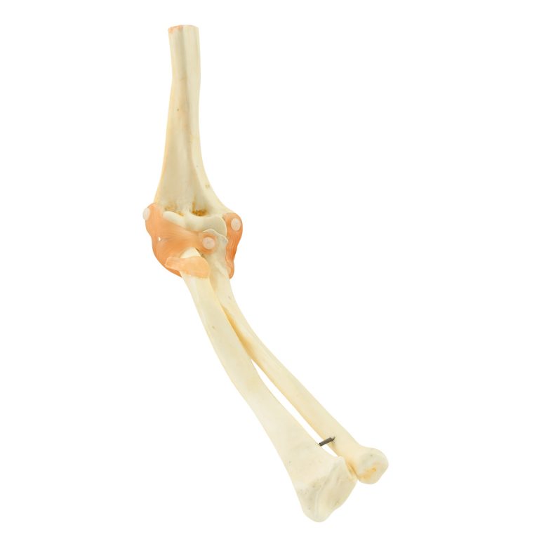 Functional Elbow Joint - SIM-MOD